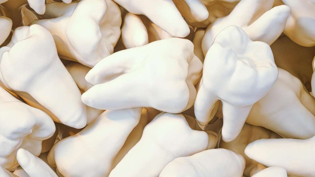 Biting the Dust: Your Guide to Wisdom Teeth Removal | Family Dentistry ...